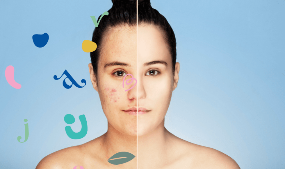 Het before-en-after effect: waarom het werkt